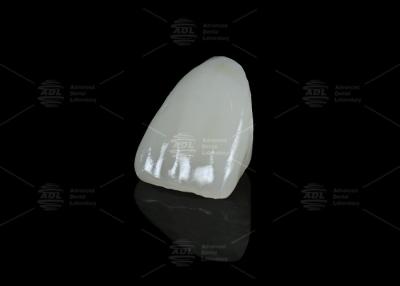 China China Dental Lab Hybrid Ceramic Vita Enamic Dental with Translucency for Single Tooth Restorations for sale