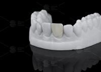 China China Dental Lab Hybrid Ceramic Vita Enamic Dental with Translucency for Single Tooth Restorations for sale