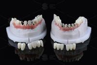 China China Dental Lab Titanium Full Arch Hybrid Bridge with Immediate Loading A1 Shade Malong Design Screw Retained Cad/Cam for sale