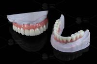 China China Dental Lab Titanium Full Arch Hybrid Bridge with Immediate Loading A1 Shade Malong Design Screw Retained Cad/Cam for sale