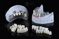 China China Dental Lab Titanium Full Arch Hybrid Bridge with Immediate Loading A1 Shade Malong Design Screw Retained Cad/Cam for sale
