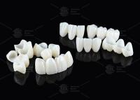 China China Dental Lab Titanium Full Arch Hybrid Bridge with Immediate Loading A1 Shade Malong Design Screw Retained Cad/Cam for sale