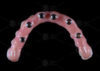 China China Dental Lab Titanium Screw Retained Malong Design A1 Shade Full Arch Hybrid Bridge for sale