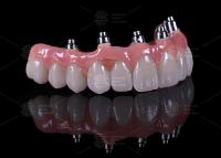 China China Dental Lab Titanium Screw Retained Malong Design A1 Shade Full Arch Hybrid Bridge for sale