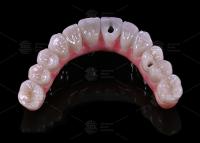 China China Dental Lab Titanium Screw Retained Malong Design A1 Shade Full Arch Hybrid Bridge for sale
