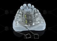 China China Dental Lab Colorful Stainless Steel Screw Expander for Maxilla and Mandible Expansion for sale