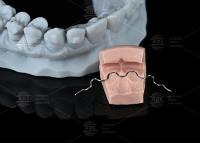 China China Dental Lab Invisible Strong U Shape Lingual Wire Retainer Single Strand Comfort Level for Orthodontic Treatment for sale