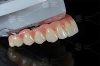 China Digital Dental Design Services Delivering Detailed Virtual Models And Customized Treatment Planning Including Crown And Bridge Design for sale