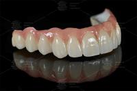 China Digital Dental Design Services Delivering Detailed Virtual Models And Customized Treatment Planning Including Crown And Bridge Design for sale