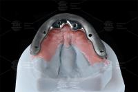 China Digital Dental Design Services Delivering Detailed Virtual Models And Customized Treatment Planning Including Crown And Bridge Design for sale