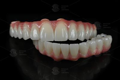China Dental Lab Shenzhen Specializing In Custom Dental Prosthetics Crowns Bridges Implants And Orthodontic Appliances For Dental Practices for sale