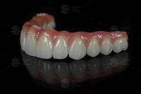 China Dental Lab Shenzhen Specializing In Custom Dental Prosthetics Crowns Bridges Implants And Orthodontic Appliances For Dental Practices for sale
