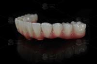 China Dental Lab Shenzhen Specializing In Custom Dental Prosthetics Crowns Bridges Implants And Orthodontic Appliances For Dental Practices for sale