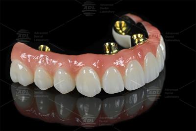 China Professional Dental Lab Outsourcing Services Delivering Accurate Dental Prosthetics and Custom Solutions for Dental Industry Needs for sale