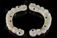 China Professional Dental Lab Outsourcing Services Delivering Accurate Dental Prosthetics and Custom Solutions for Dental Industry Needs for sale