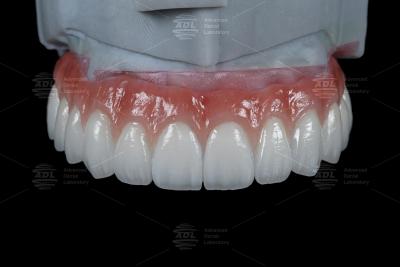 China High Translucency Layered Zirconia Crown And Bridge With Natural Esthetics And Precise Fit For Dental Lab Restorations for sale