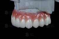 China High Translucency Layered Zirconia Crown And Bridge With Natural Esthetics And Precise Fit For Dental Lab Restorations for sale