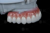 China High Translucency Layered Zirconia Crown And Bridge With Natural Esthetics And Precise Fit For Dental Lab Restorations for sale