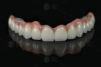 China Natural Looking PFM Implant  Bridge with Precise Fit and Co Cr Alloy Framework for Porcelain Fused To Metal Crown And Bridge Restorations for sale