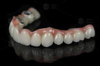China Natural Looking PFM Implant  Bridge with Precise Fit and Co Cr Alloy Framework for Porcelain Fused To Metal Crown And Bridge Restorations for sale