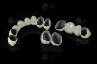 China Precise Fit High Esthetic Precious Alloy PFM Crown Porcelain Fused To Metal Crown for Dental Lab for sale