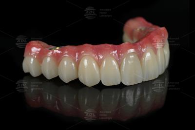 China China Dental Lab Malo Zirconia Bridge Implant Supported Screw Retained Full Arch Restoration for sale