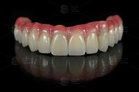 China China Dental Lab Malo Zirconia Bridge Implant Supported Screw Retained Full Arch Restoration for sale