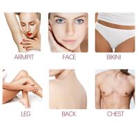 China Skin Care Diode Laser Hair Removal Machine Multifunctional IPL Instrument for sale