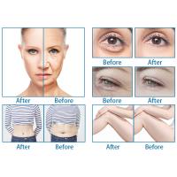 China Beauty HIFU Slimming Machine 5 In 1 Multifunction 5D Wrinkle Removal Device for sale