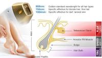China Palladium Bar Imported From Germany Diode Laser Hair Removal Machine Spot Size 15*15mm for sale