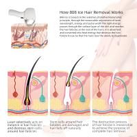 China Customizable Diode Laser Hair Removal Machine For Commercial for sale