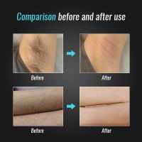 China Top Stack Real 20 Million Diode Laser Hair Removal Machine With 3000W-5000W Power for sale