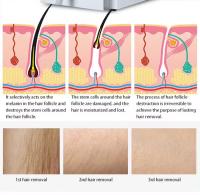 China Advanced 808nm Diode Laser Hair Removal Machine 10.4 Inch Touch Screen Water Air Semiconductor Cooling Aluminum Box for sale