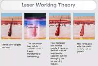 China Custom Logo Diode Laser Hair Removal Machine 755nm 808nm 1064nm 16bar Laser Bar Skin Rejuvenation for sale