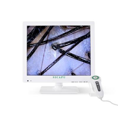 China 17 Inch Screen Hair Analyzer Machine with 2.0 Megapixel Camera and 70x Magnification for Professional Scalp Analysis for sale
