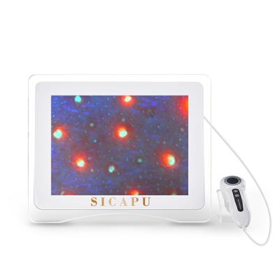 China 15 Inch HD Skin Analyzer with 70x Magnification and 2MP Resolution for Professional Skin Testing for sale
