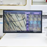 China Hair Analysis Testing Machine Hair And Scalp Testing Machine for sale