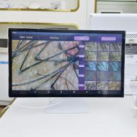 China Hair Analysis Testing Machine Hair And Scalp Testing Machine for sale