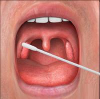 China TDS Flocked Sterile Medical Swabs Nasopharyngeal Throat Swab Plypropylene Handle for sale
