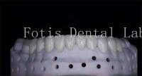 China Dental Lab Laminate Veneers 0.3-0.5mm High Strength Porcelain Veneers for Cosmetic Dentistry for sale
