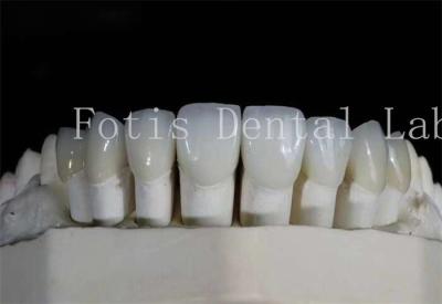 China Polished Dental Laminate Veneers High Translucency 0.3-0.5mm for Natural Smiles for sale