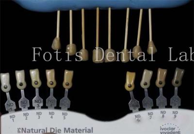 China Dental Lab Laminate Veneers 0.3-0.5mm High Translucency Porcelain Cosmetic Teeth Covers for sale