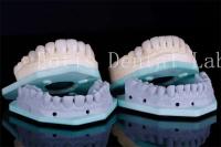 China Dental Porcelain Laminate Veneers 0.3-0.5mm Thickness Stain Resistant Natural Color for sale