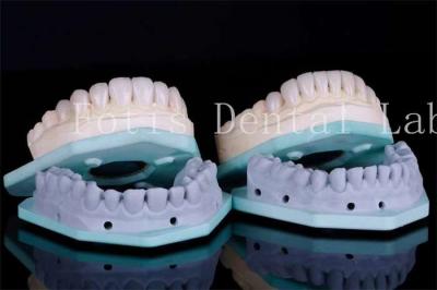 China Dental Porcelain Laminate Veneers 0.3-0.5mm Thickness Stain Resistant Natural Color for sale