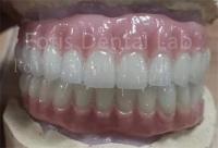 China Precise Fit Ivoclar Teeth Acrylic Complete Denture Stain Resistant for sale