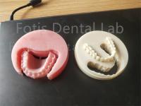 China Full Acrylic Denture with Ivoclar Teeth Comfort Fit Easy Clean for Professional Technicians for sale