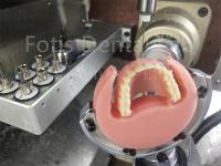 China Full Acrylic Denture Natural Color Ivoclar Teeth Customizable Fit Prosthesis for sale
