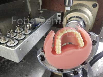 China Full Acrylic Denture Natural Color Ivoclar Teeth Customizable Fit Prosthesis for sale