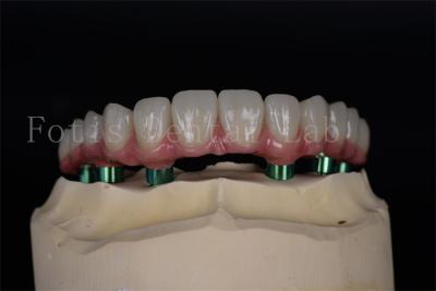 China All on 4 All on 6 Dental Implants with Zirconia Bridge 4 or 6 Implants High Success Rate for sale
