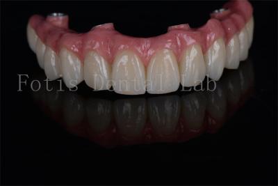 China All on 4 All on 6 Dental Implants Minimally Invasive 4 or 6 Implants Low Bone Density for sale